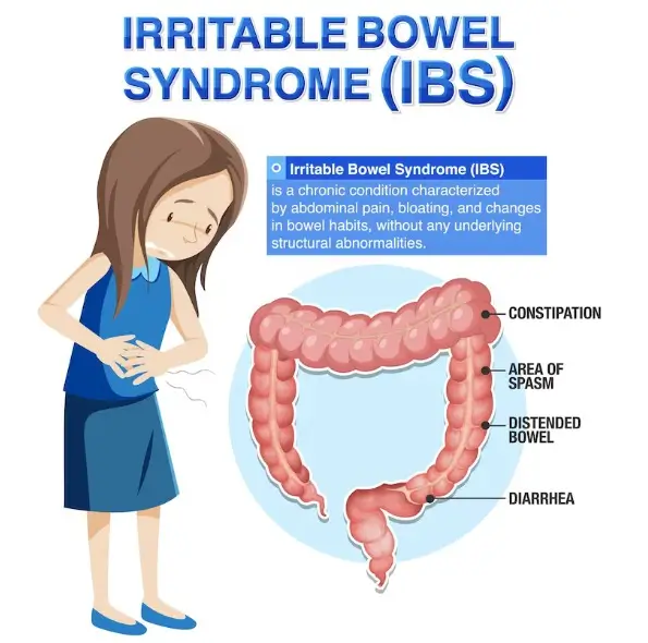 Irritable Bowel Symptoms What Is IBS Or Irritable Bowel Syndrome 